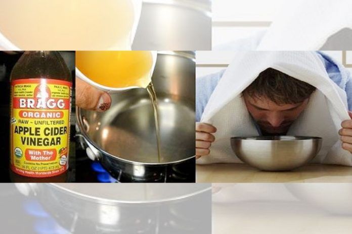 How to Get Rid of a Headache Fast at Home | Healthspectra