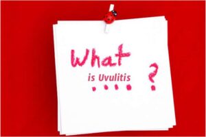 14 Natural Remedies for Uvulitis – Get Faster Relief