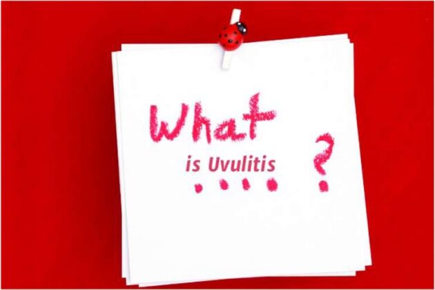14 Natural Remedies for Uvulitis – Get Faster Relief