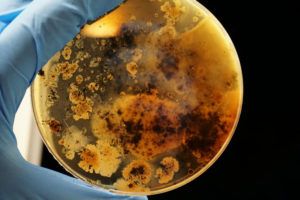 5 Types of infection That You Must Know in Detail