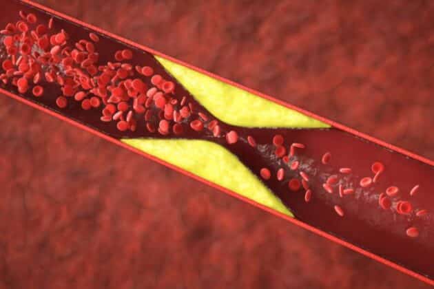 How to Manage Chronic Blood Clotting Disorders