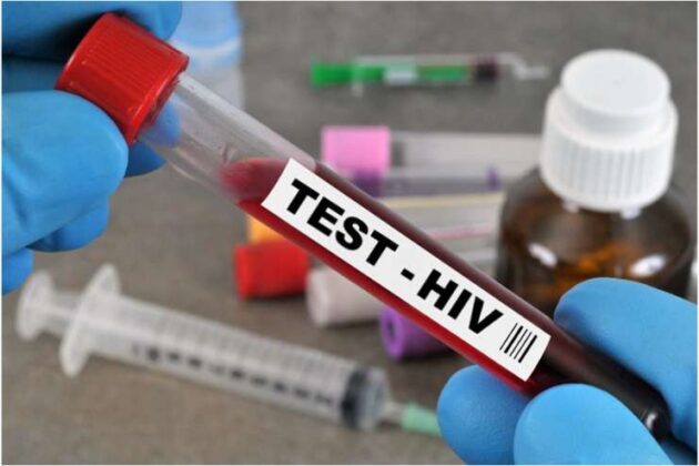 HIV vs. AIDS: Key Differences, Testing, and Prevention Explained