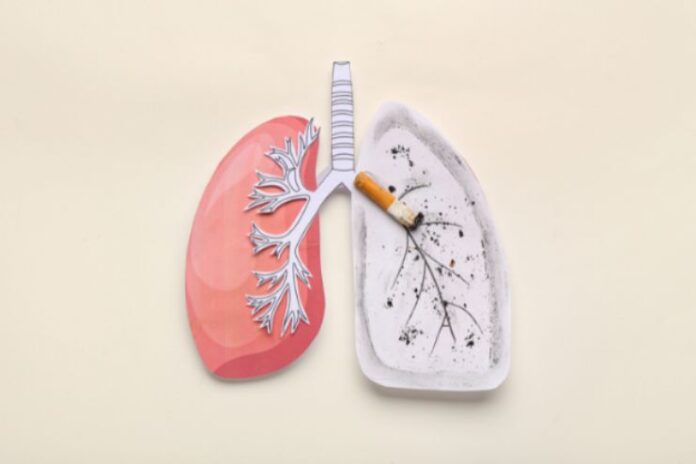 Top 10 Breathing Support Products to Enhance Lung Health Naturally
