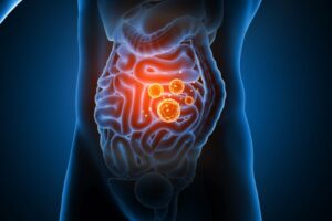 7 Warning Signs and Side Effects of Poor Digestion You Shouldn't Ignore