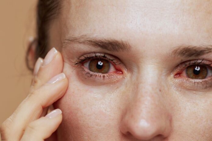 Dry Eyes in Pregnancy? Here's Why It Happens and How to Relieve It