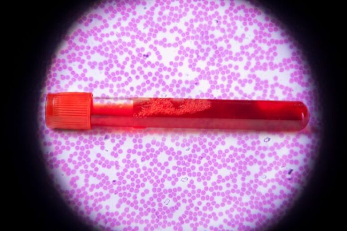 Malaria in Children: Symptoms, Treatment, and Prevention Tips for Parents