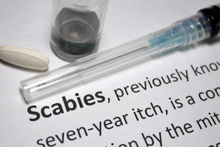 Scabies In Humans: Causes, Symptoms, And Treatment Options