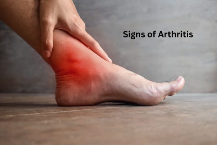 Early Signs of Arthritis in Your 30s You Shouldn’t Ignore