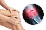 Is Cracking Your Joints Bad for You? What Science Really Says