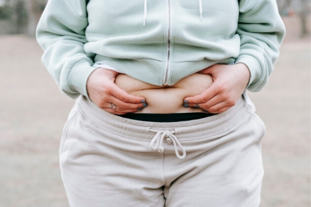 PCOS Belly Fat: Why It Happens and How to Reduce It Naturally