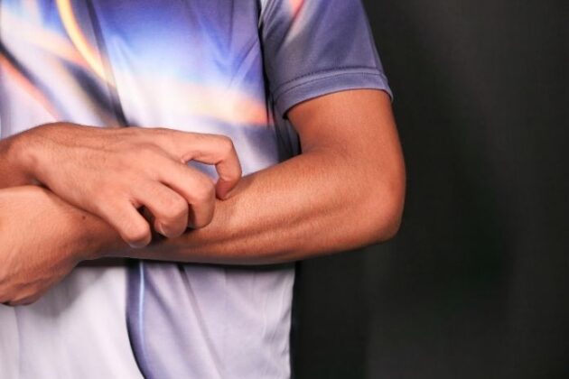 7 Types of Moles on Your Body That Could Signal Serious Health Issues