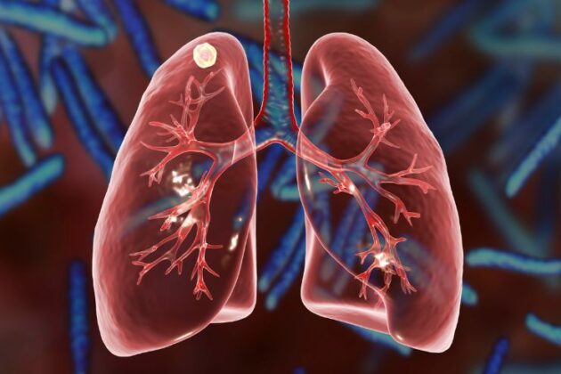 How to Check Your Lung Health at Home: Simple Tests and Warning Signs ...