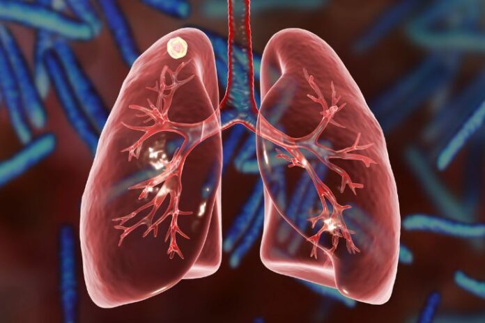 How to Check Your Lung Health at Home: Simple Tests and Warning Signs ...