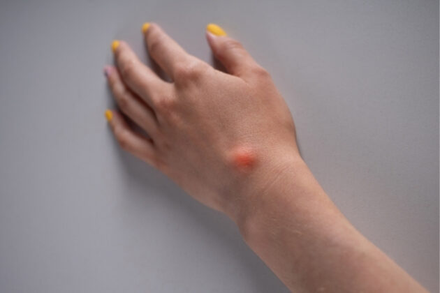 Hard Lump Under the Skin: Causes, Diagnosis, and When to Worry