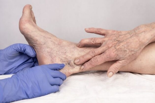 Why Are My Hand Veins Suddenly Bulging? Common Causes Explained
