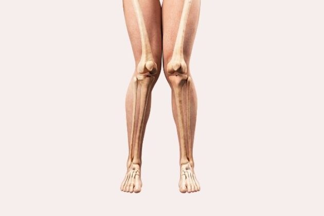 Understanding Knock Knees: Causes, Treatment, and Prevention Strategies
