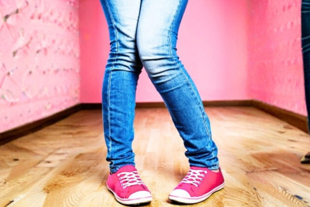 Understanding Knock Knees: Causes, Treatment, and Prevention Strategies