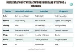 Dark Skin Under Breasts: Acanthosis Nigricans vs Intertrigo vs Ringworm ...