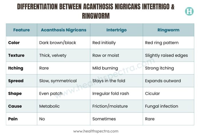 Dark Skin Under Breasts: Acanthosis Nigricans vs Intertrigo vs Ringworm ...